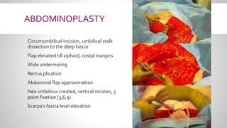 Abdominoplasty - Dr Mujtuba Pervez Khan | PPTX