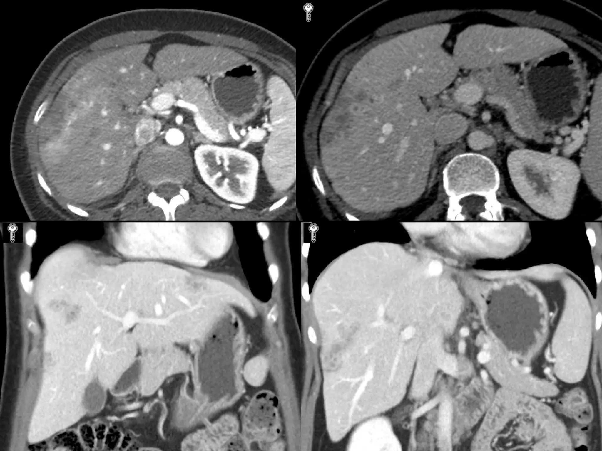 NERRS Abdominal Radiology Unknowns Sep 2012 | PPT