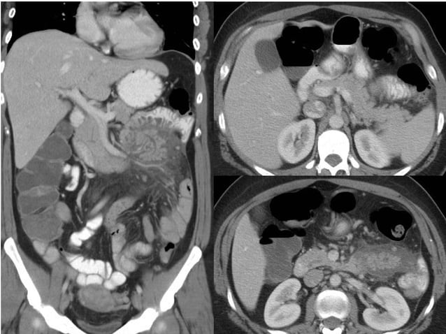 NERRS Abdominal Radiology Unknowns Sep 2012 | PPT