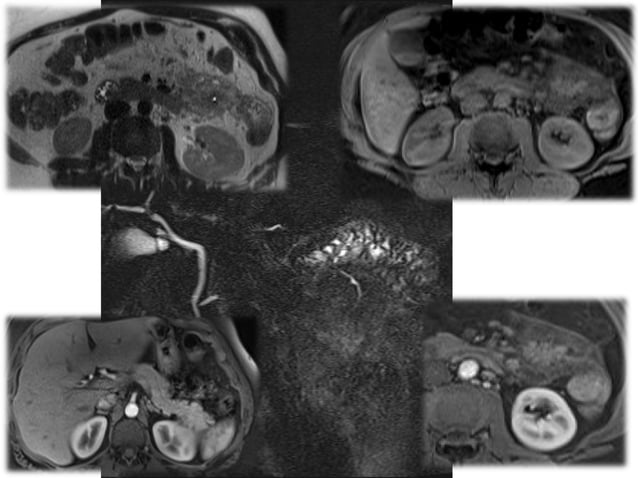 NERRS Abdominal Radiology Unknowns Sep 2012 | PPT