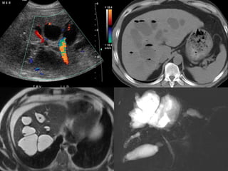 NERRS Abdominal Radiology Unknowns Sep 2012 | PPT