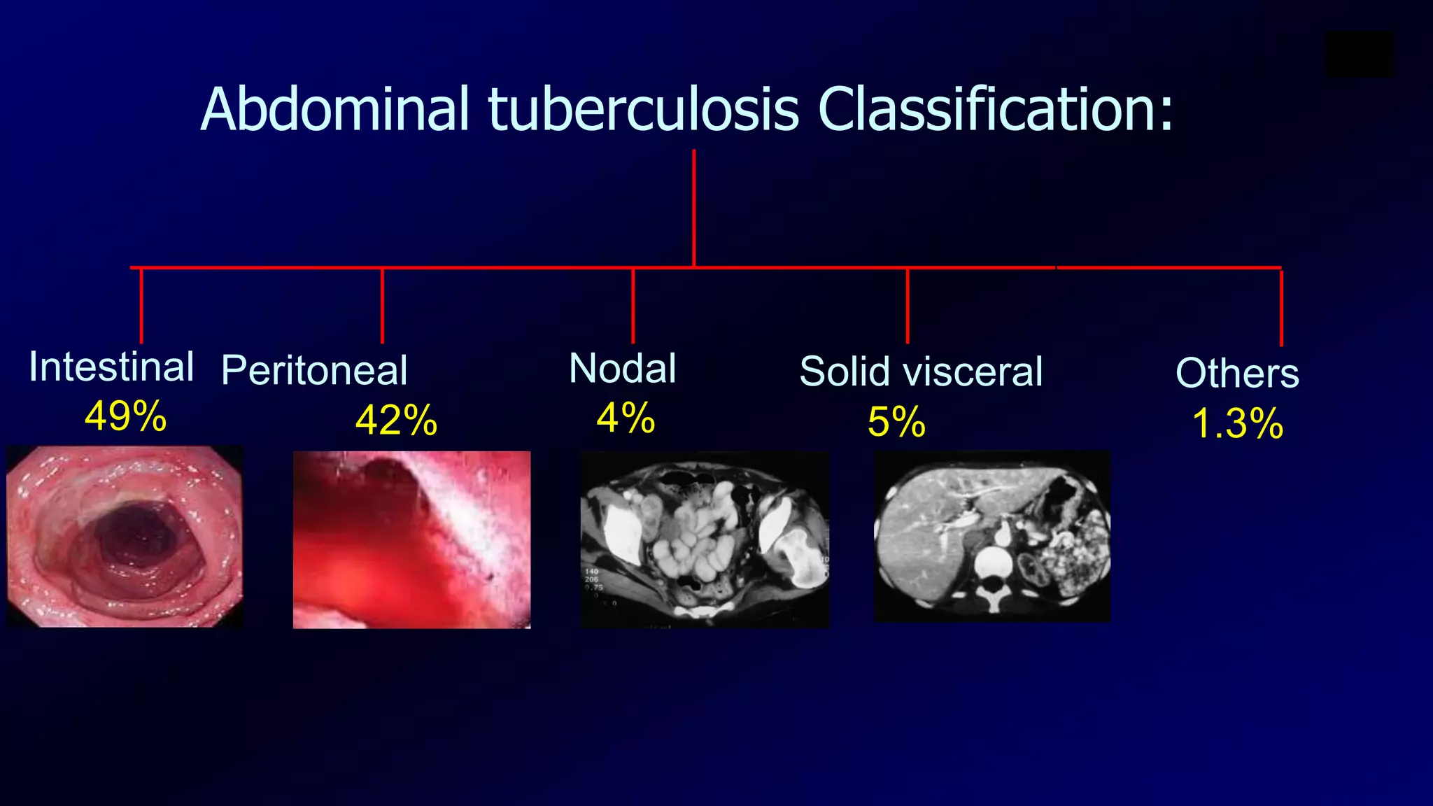 Abdominal Tuberculosis | PPTX