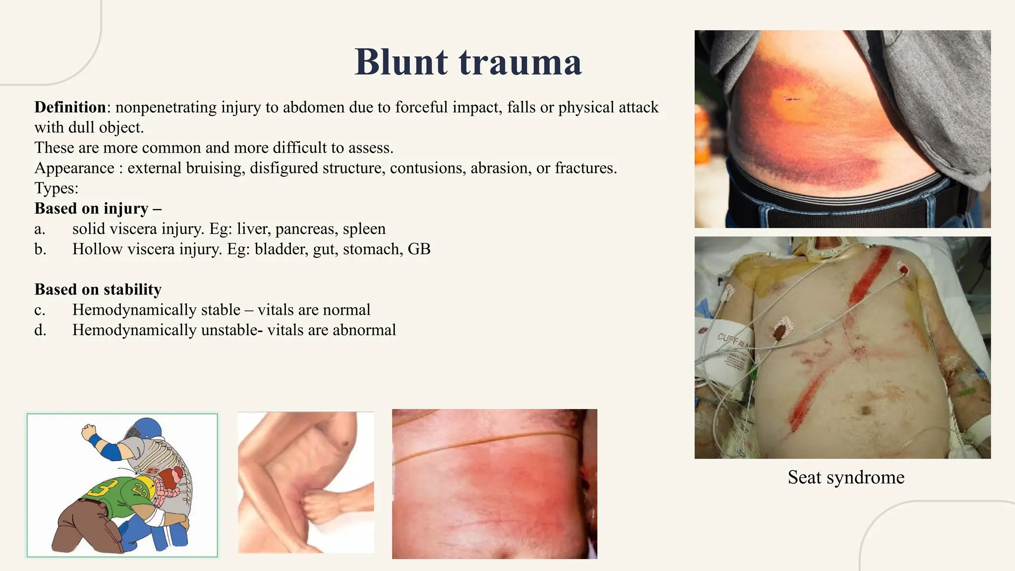 abdominal trauma basics, diagnosis, treatment, organ wise ...