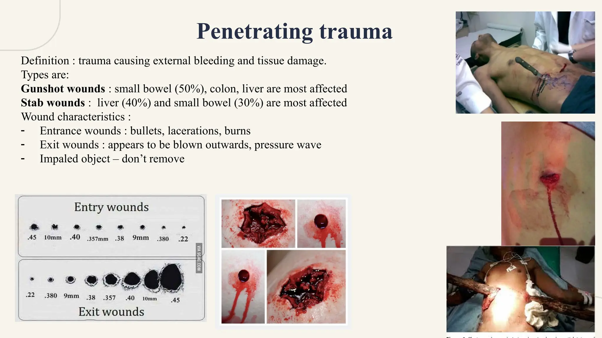 abdominal trauma basics, diagnosis, treatment, organ wise ...