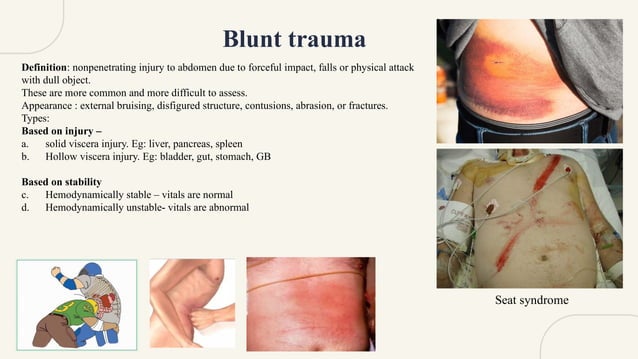abdominal trauma basics, diagnosis, treatment, organ wise ...