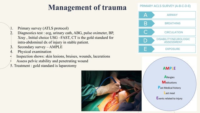 abdominal trauma basics, diagnosis, treatment, organ wise ...