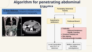 abdominal trauma basics, diagnosis, treatment, organ wise ...