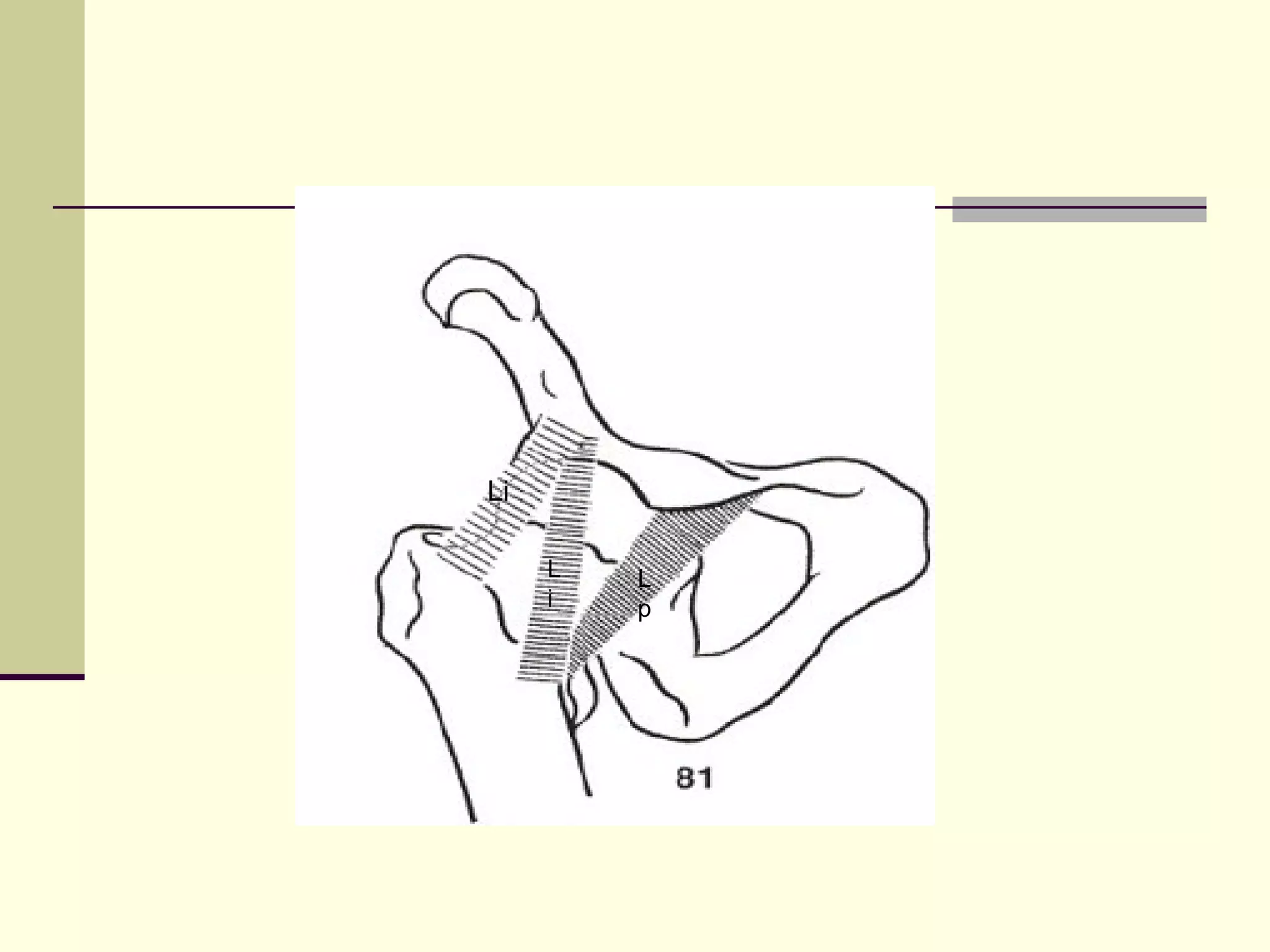 Abducción y aduccion de cadera.ppt completo | PPT