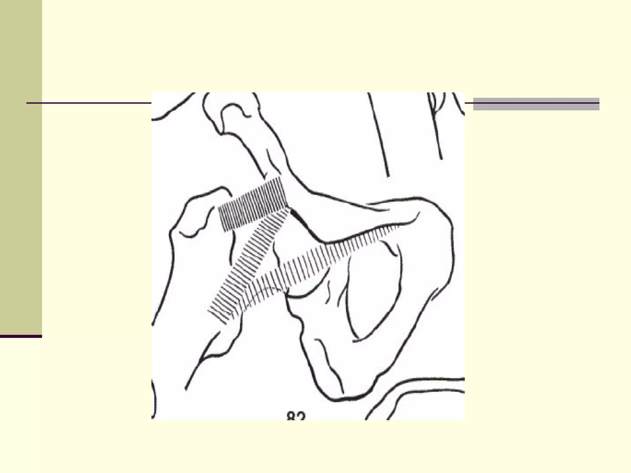 Abducción y aduccion de cadera.ppt completo | PPT