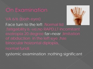 6 th nerve palsy | PPT