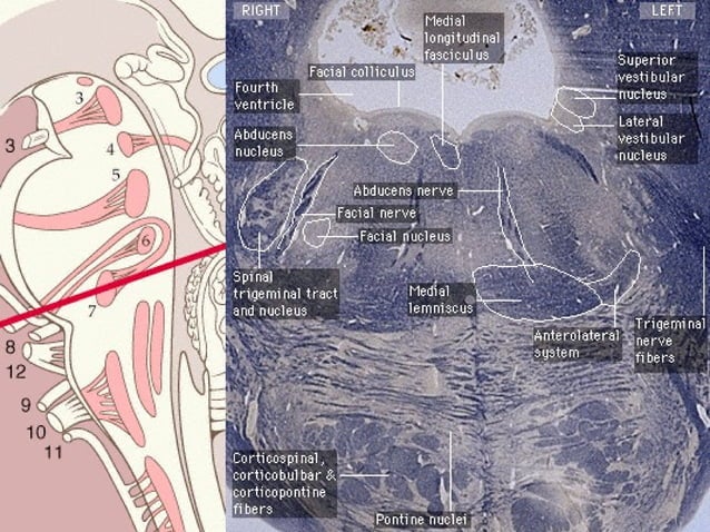 Abducent nerve | PPT