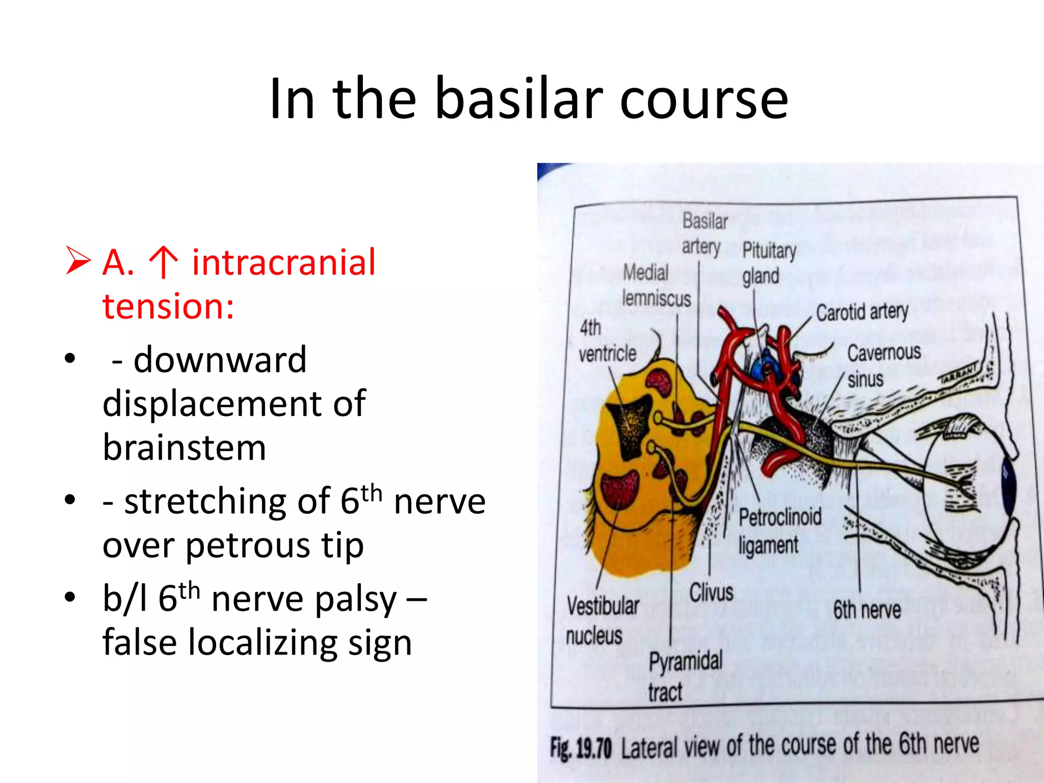 Abducent nerve dnm | PPTX