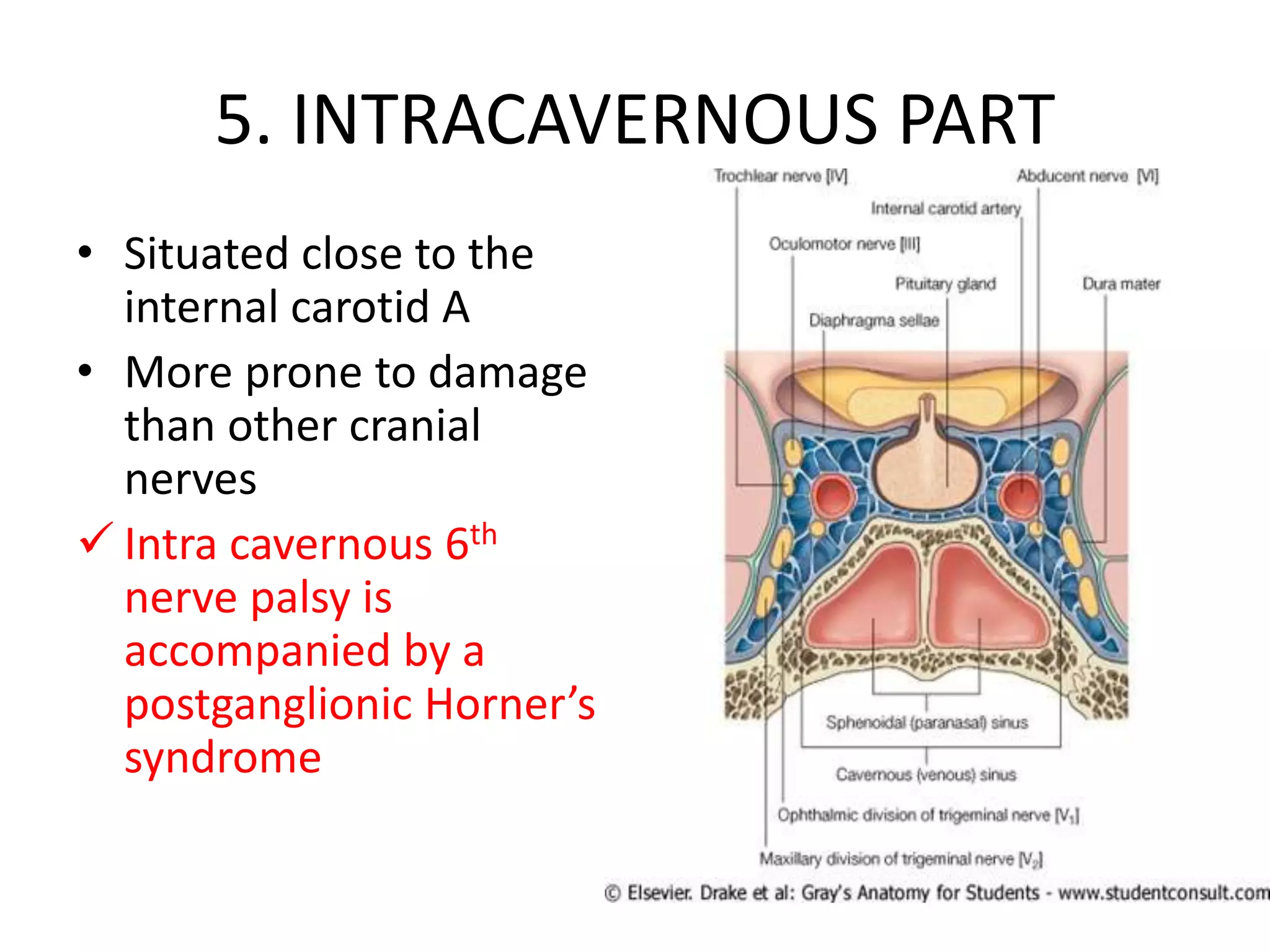 Abducent nerve clinical anatomy | PPTX