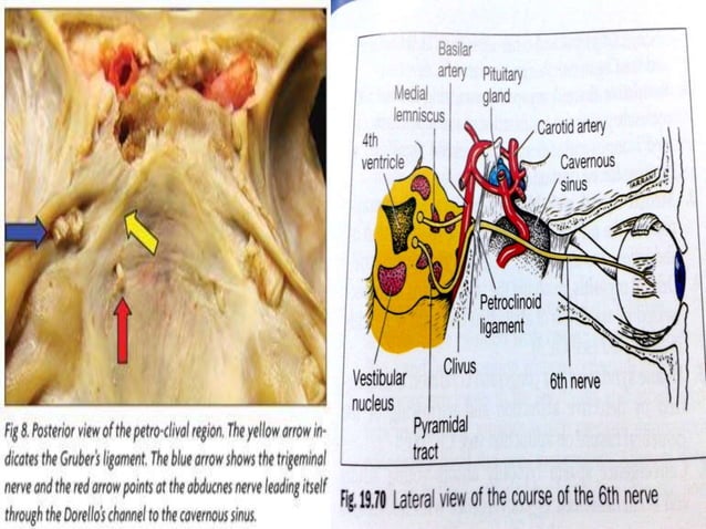 Abducent nerve clinical anatomy | PPTX | Ear, Nose and Throat ...