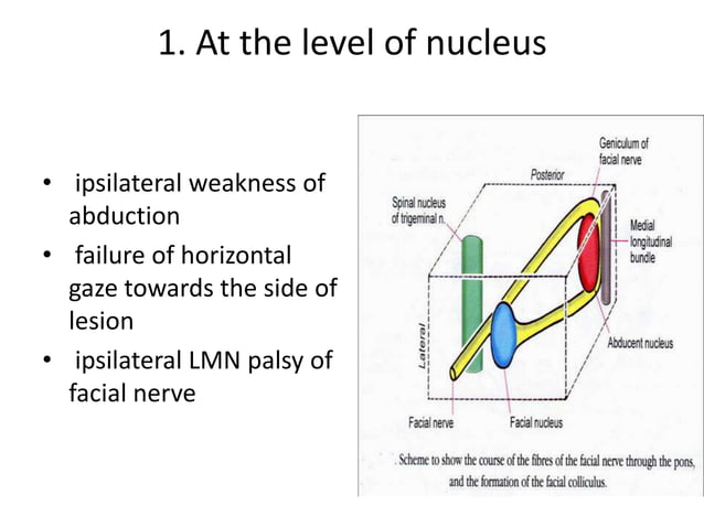 Abducent nerve clinical anatomy | PPTX | Ear, Nose and Throat ...