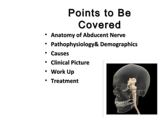 Abducent nerve palsy | ODP