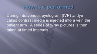 intravenous pyelogram (IVP) . abdul hakeem and atif iqbal .ppt