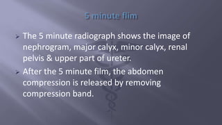 intravenous pyelogram (IVP) . abdul hakeem and atif iqbal .ppt