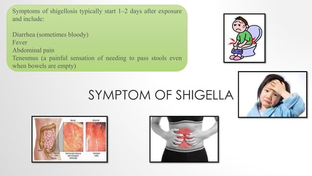 Season Plan for Ebola Virus Disease and Shigella Bacteria | PPTX | Infectious Diseases ...