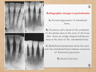 Abdullah .radiographic-aids-in-the-diagnosis-of-periodontal-diseases.pptx