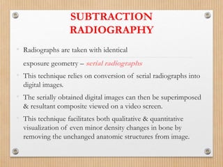 Abdullah .radiographic-aids-in-the-diagnosis-of-periodontal-diseases.pptx