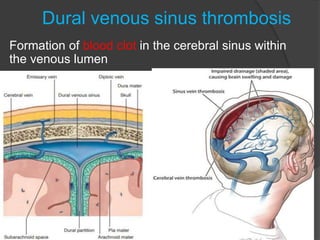 Scalp infection and its complications.pptx | Skin and Dermatology ...
