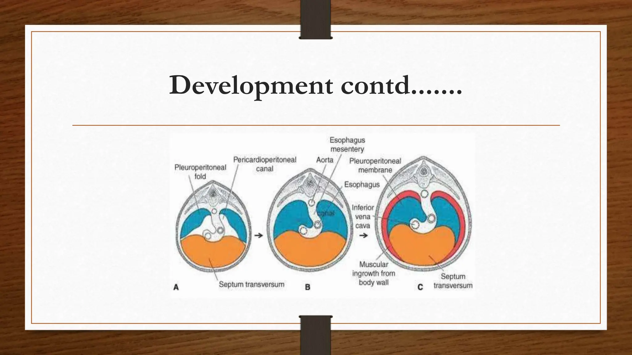 Development of diaphragm. Anatomy abdomen . Clinical aspects of ...