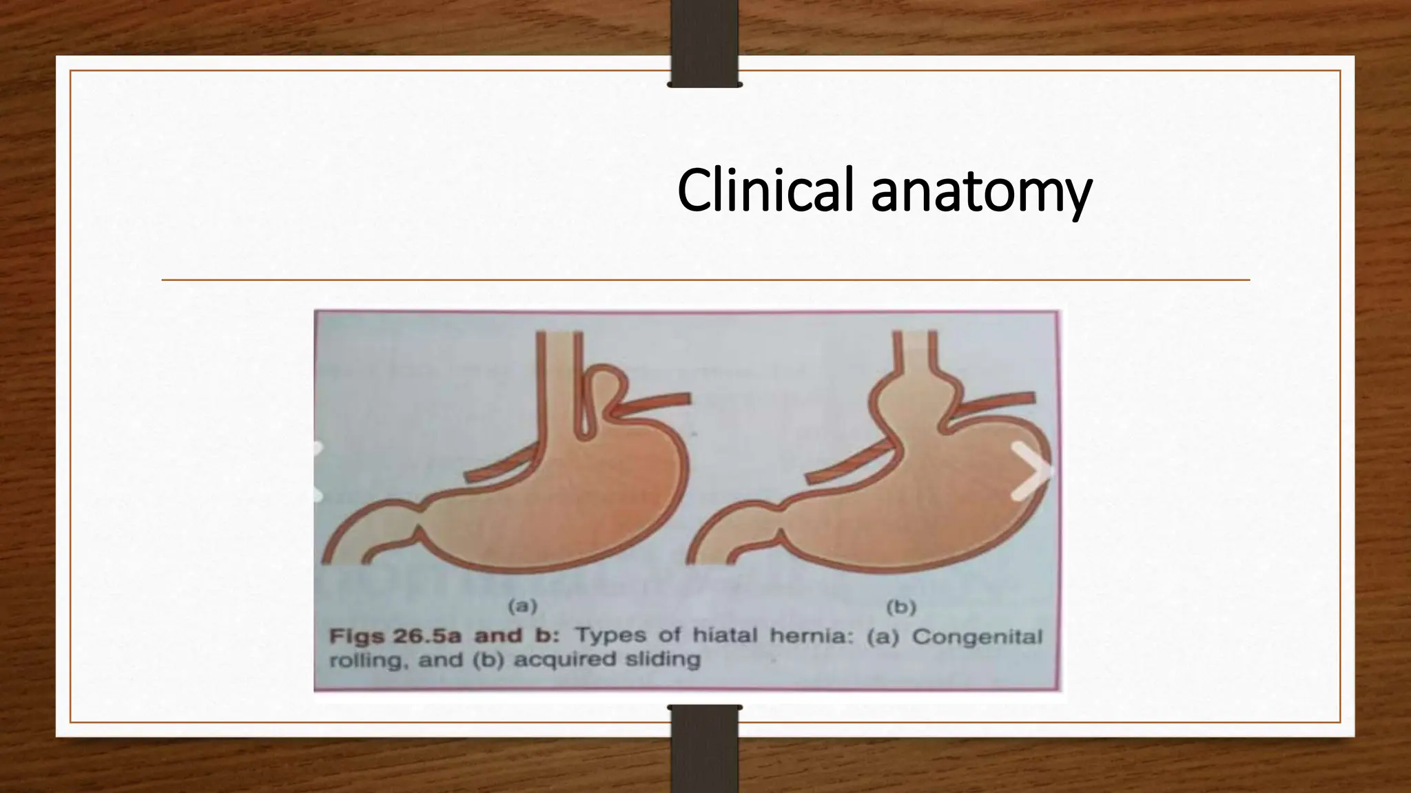 Development of diaphragm. Anatomy abdomen . Clinical aspects of ...