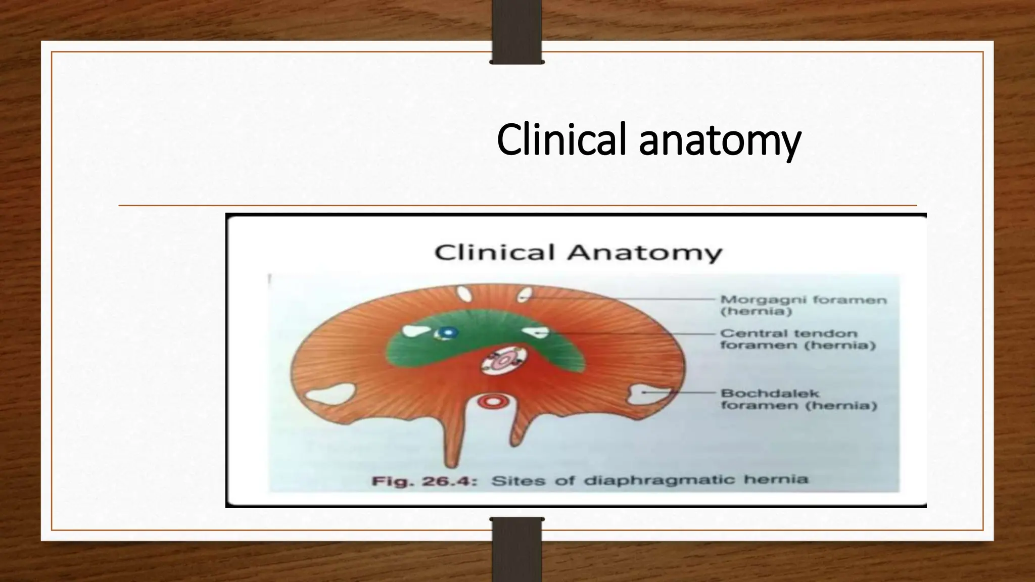 Development of diaphragm. Anatomy abdomen . Clinical aspects of ...