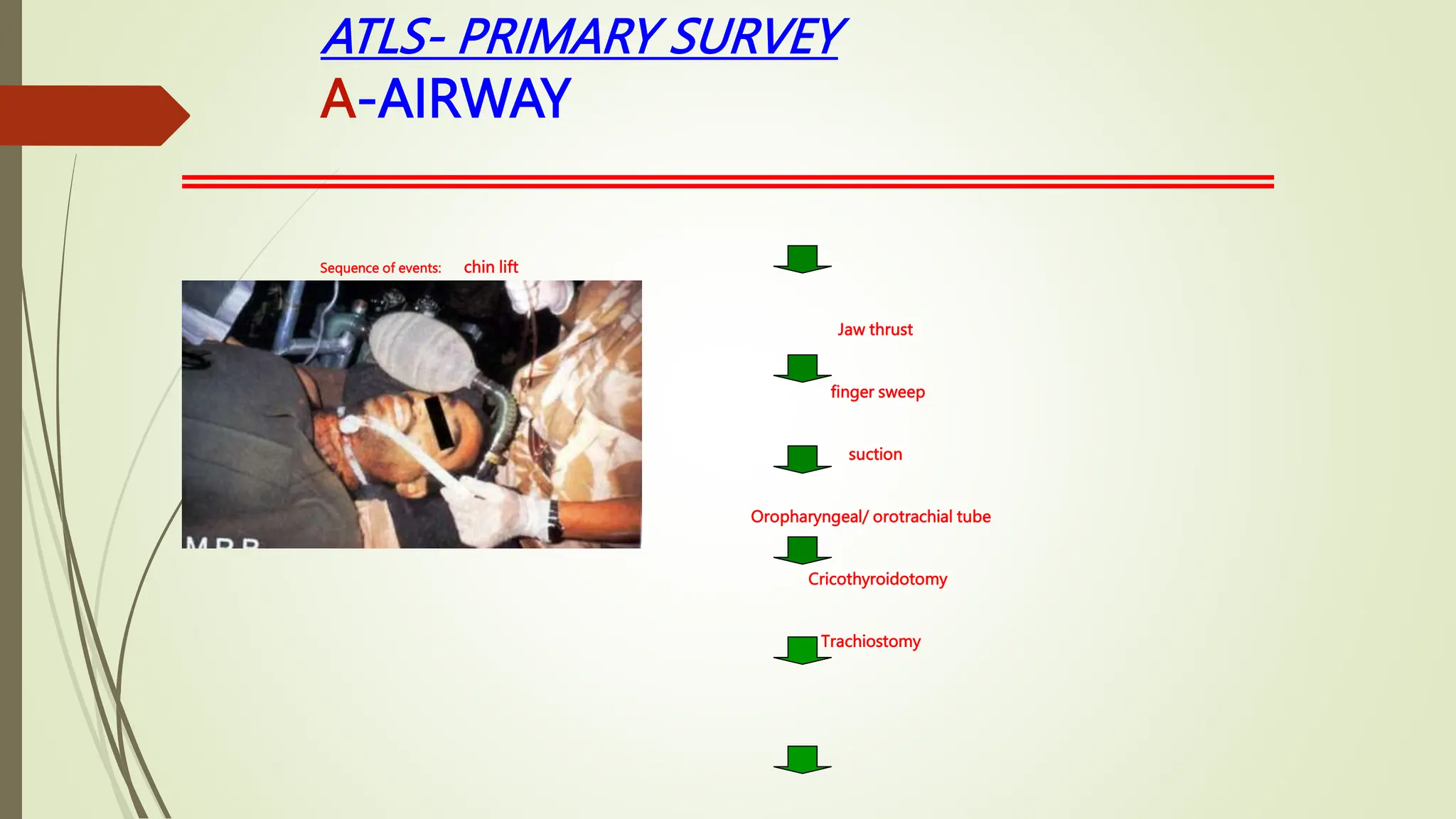 Multiple trauma and it’s definition , classification | PPTX