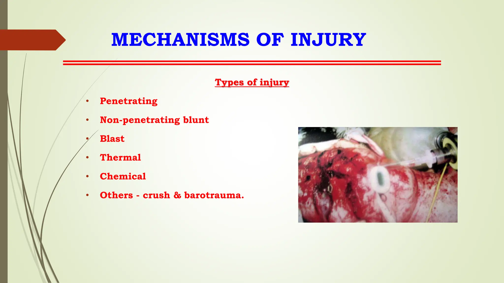 Multiple trauma and it’s definition , classification | PPTX