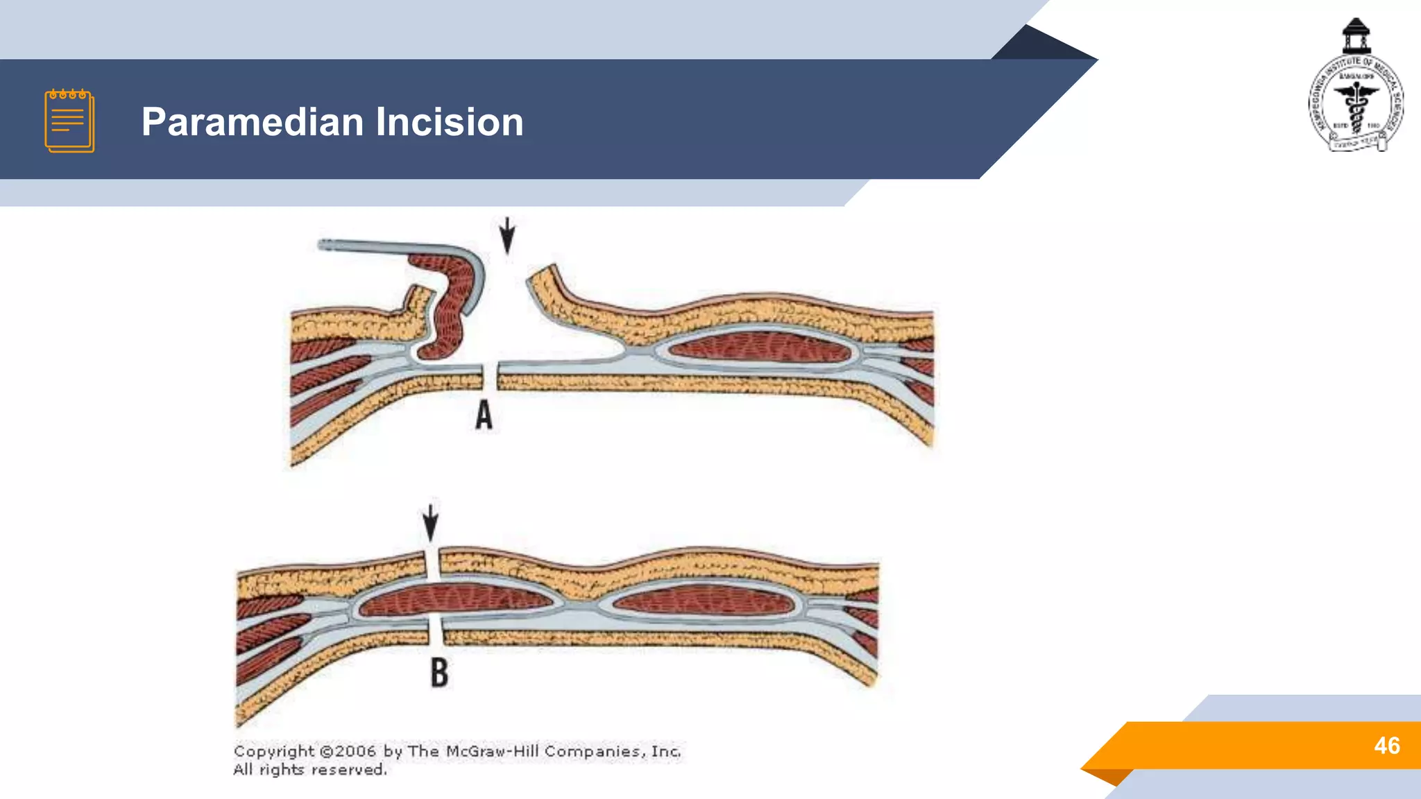 ANATOMY OF ANTERIOR ABDOMINAL WALL | PPTX