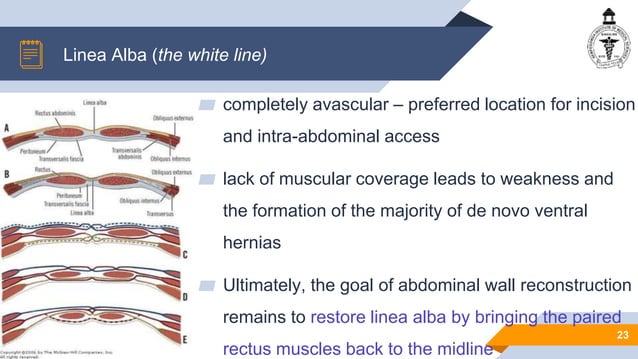 ANATOMY OF ANTERIOR ABDOMINAL WALL | PPTX