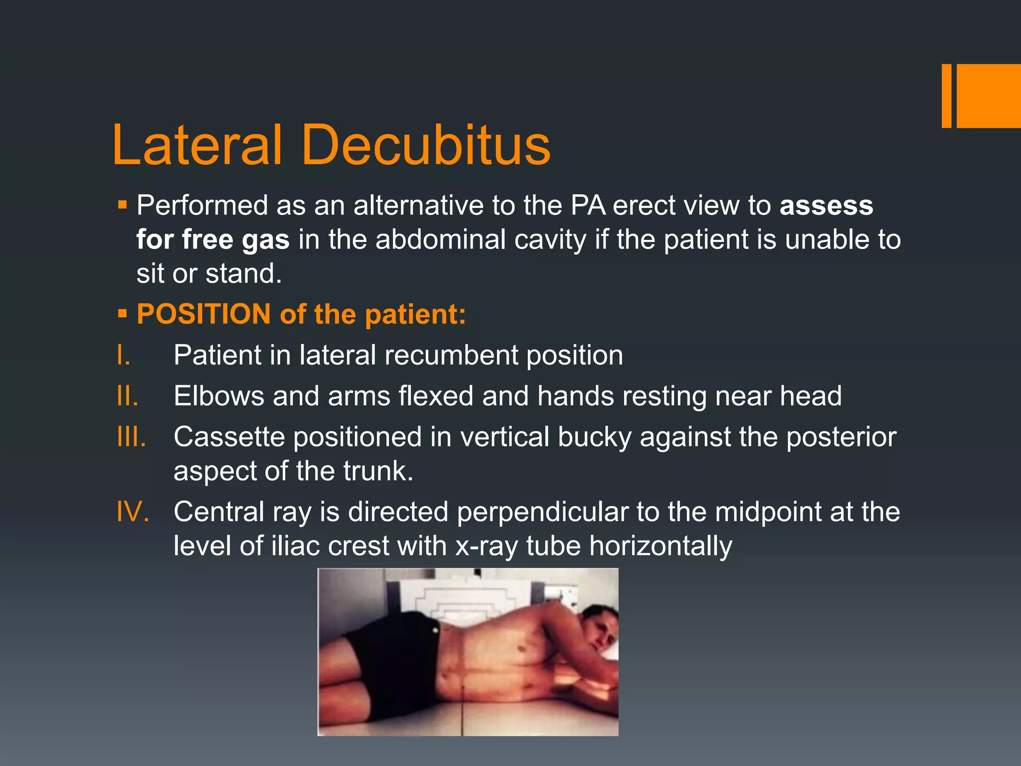 Abd xray | PPTX