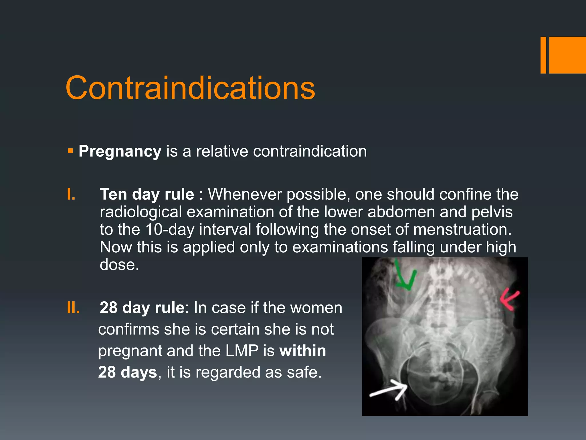 Abd xray | PPTX