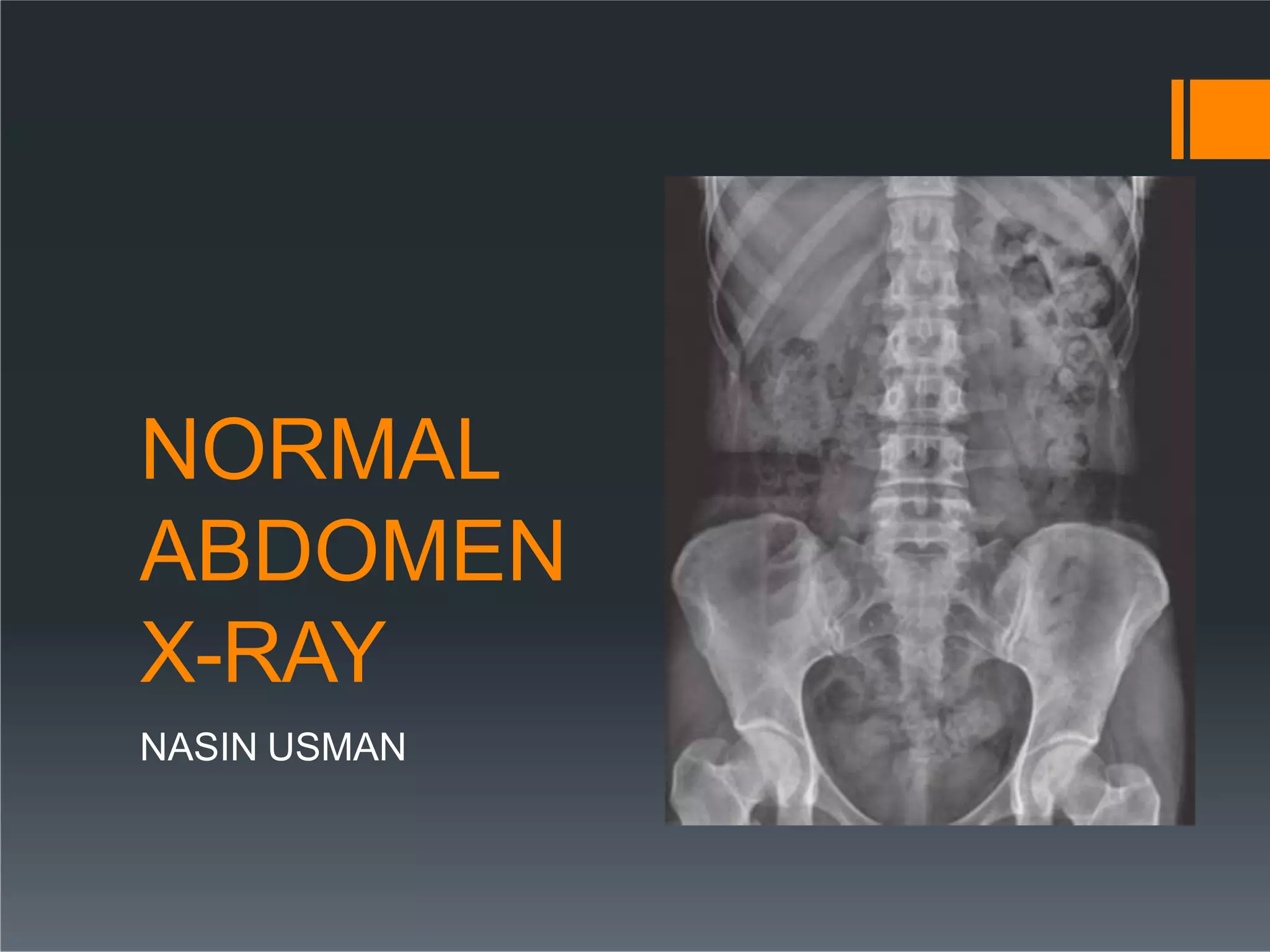 abdxray-170716043820 (1).pptx