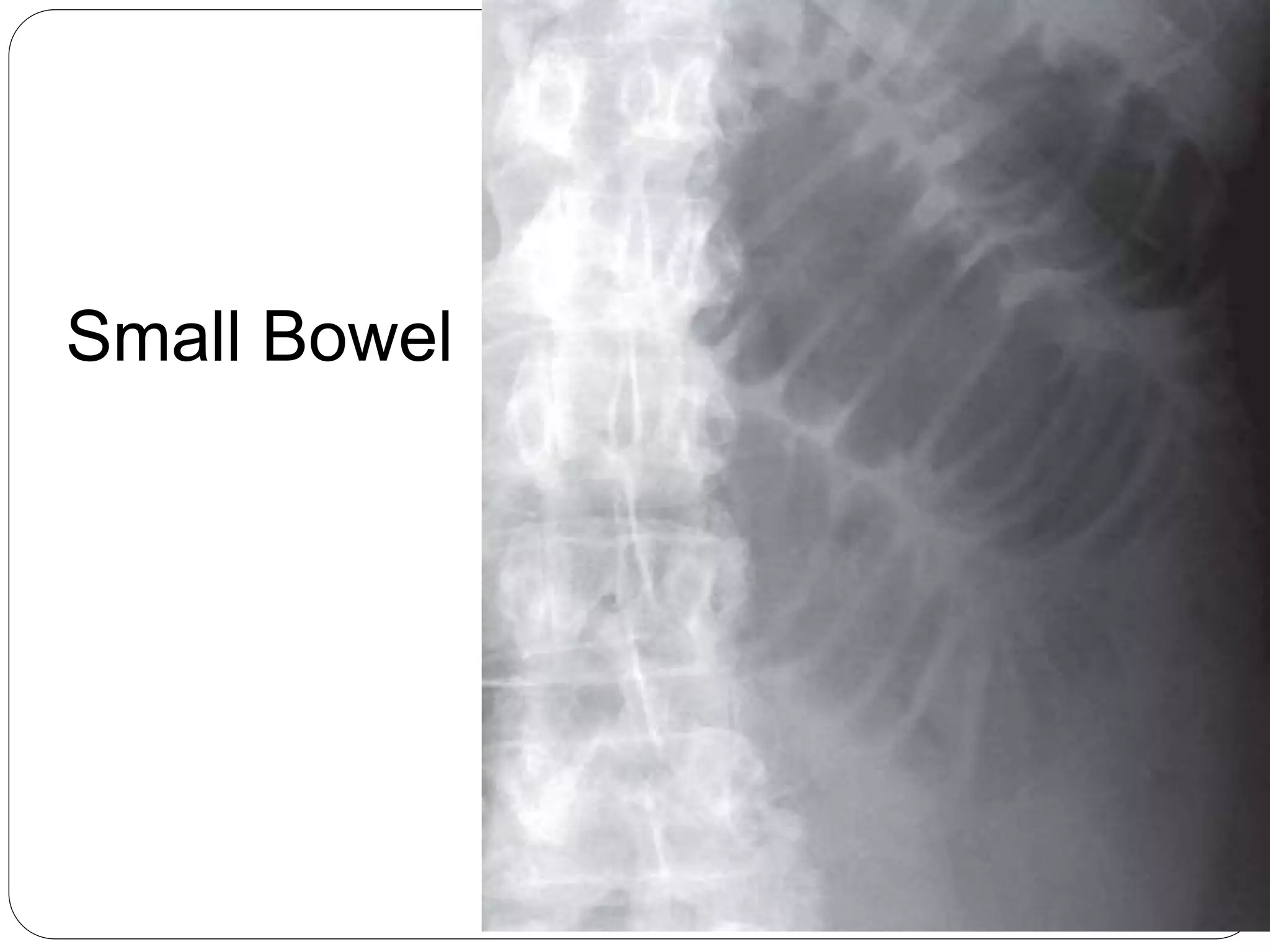 abdominal x ray radiology | PPTX