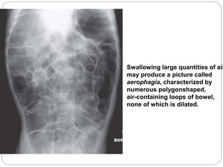abdominal x ray radiology | PPTX