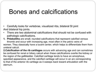 abdominal x ray radiology | PPTX