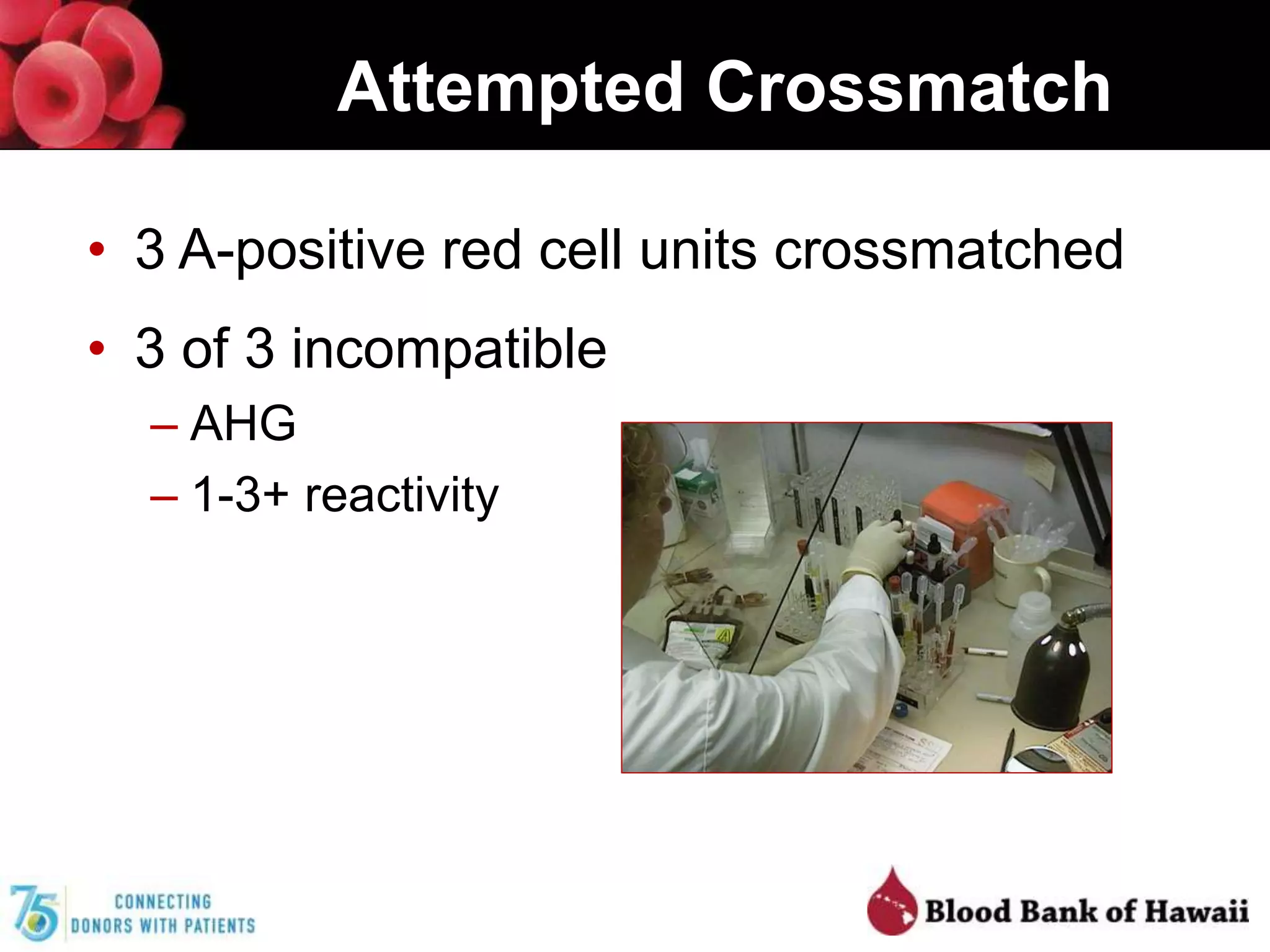 IRL Case Study by Karen Abed, MT (ASCP) SBB | PPTX
