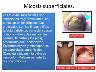 MICOSIS SUPERFICIALES | PPTX