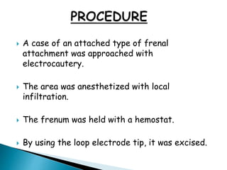 Aberrant frenum and its treatment | PPTX