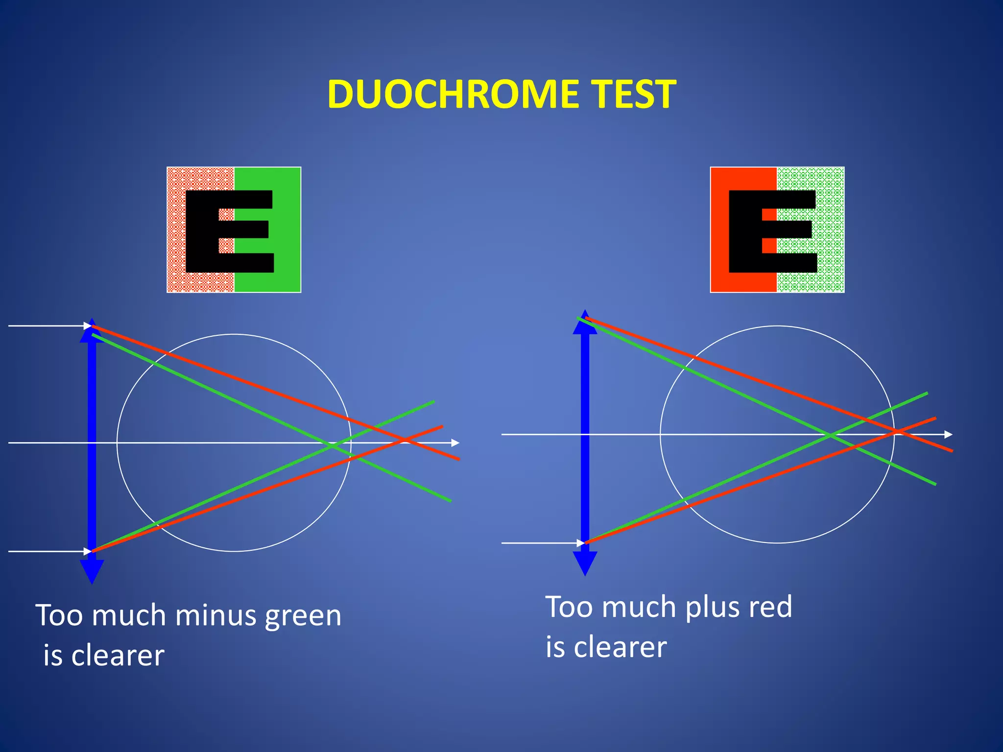 Aberration and Ophthalmic Lens Design.ppt