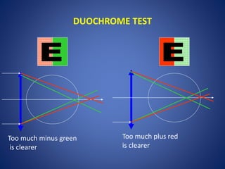 Aberration and Ophthalmic Lens Design.ppt