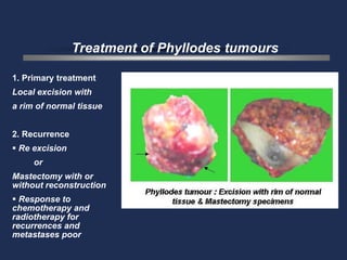 ABERRATION IN NORMAL DEVELOPMENT AND INVOLUTION | PPTX