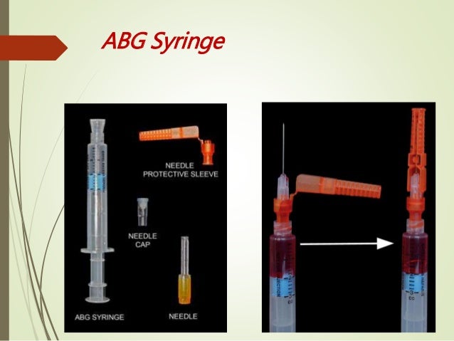 Arterial Blood Gas (ABG) analysis