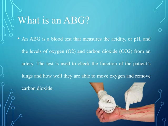 Rapid clinical interpretation of ABG | PPT