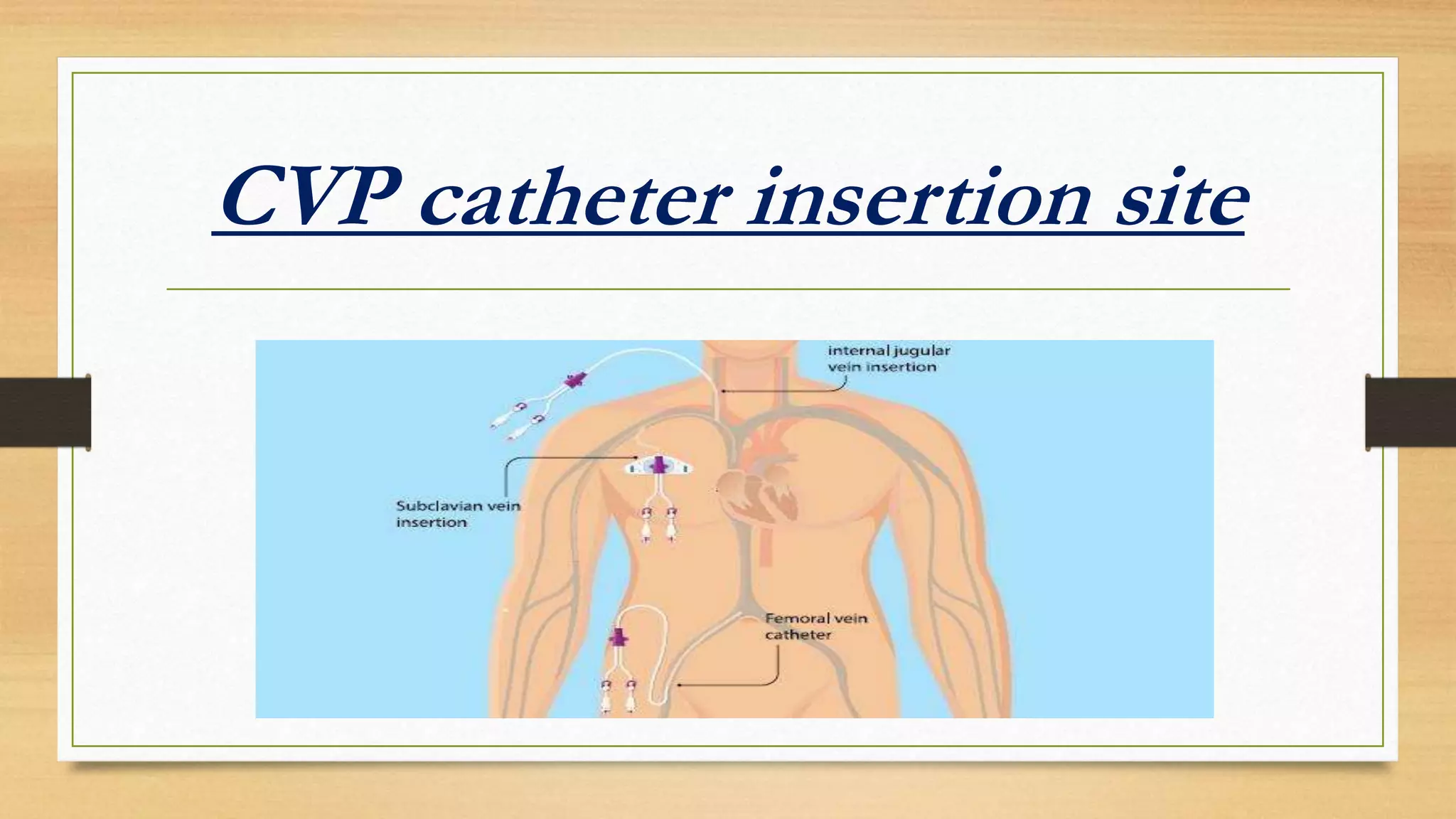 ABG ^0 CVP Monitoring.ppt