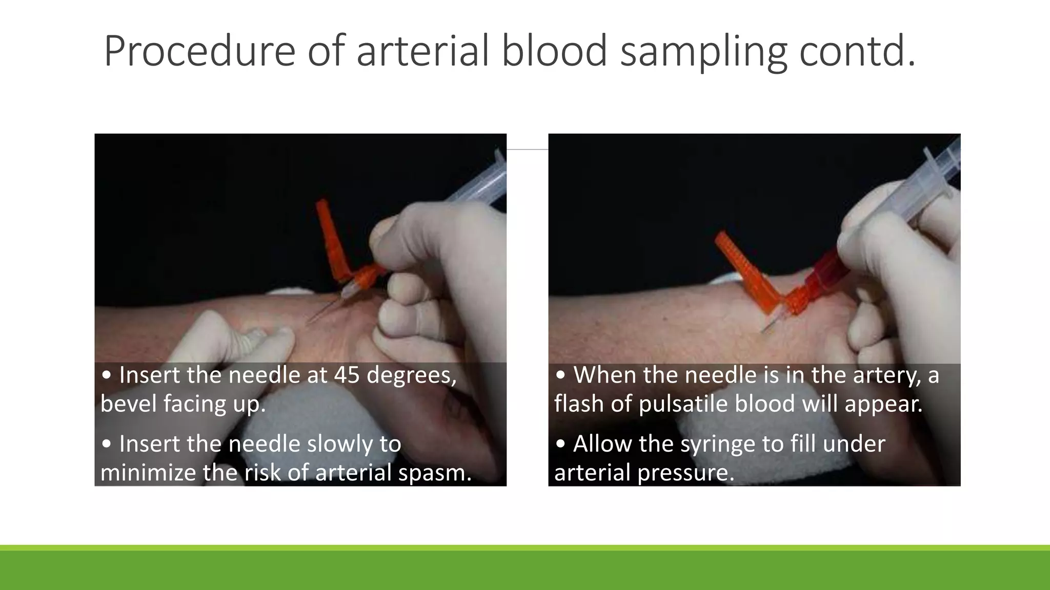 ABG Analysis in Pediatrics | PPTX