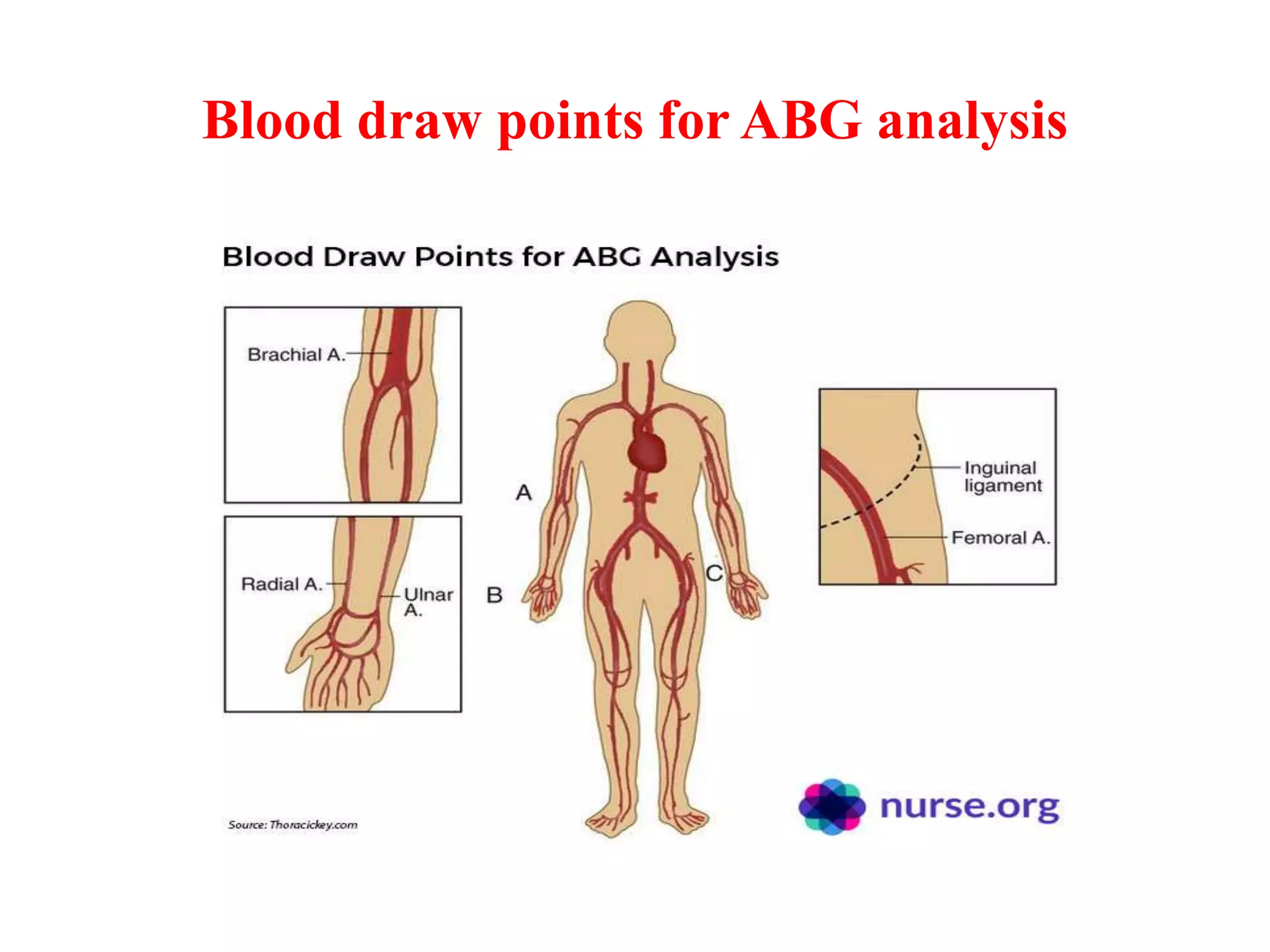 ABG Analysis ppt | PPTX